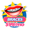 Prepay and Save: $1000 off Braces - Somos Dental, Dallas